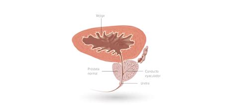 Diagrama De Anatomía De La Próstata La Estructura De La Próstata