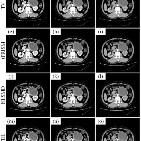 Hengyong Yu Wake Forest University North Carolina Wfu