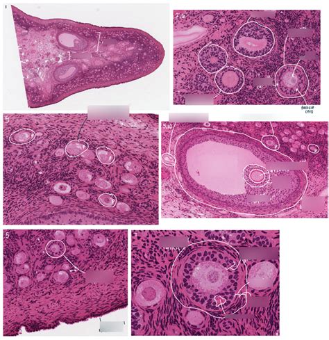 Female Reproduction Histology Slide 10 Diagram Quizlet