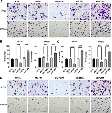 Pgm1 Inhibited Cell Invasion And Migration A Migration Ability Of The Download Scientific