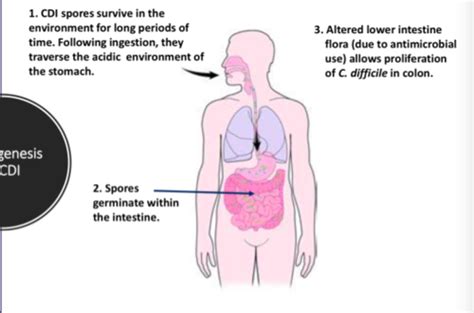 Clostridium Difficile Quizlet