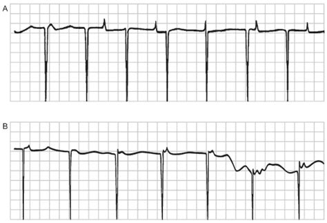 Programming Maximizing Benefit And Minimizing Morbidity Programming