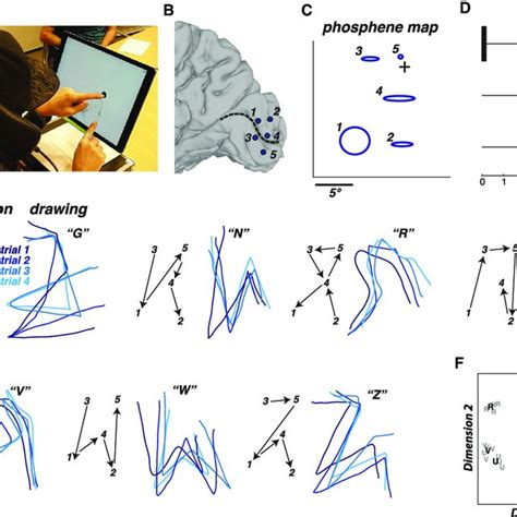 Stimulation Paradigms For Visual Cortical Prosthetics Download Scientific Diagram