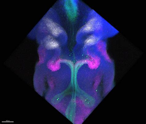 Molecular Instruments On Linkedin Withhcr