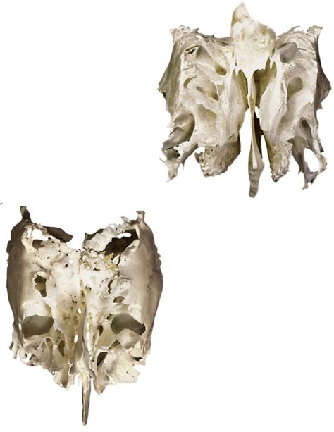 Ethmoid Bone Diagram Quizlet