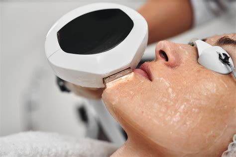 The Benefits Of Inmode Lumecca Ipl Photo Rejuvenation For Clearer Skin