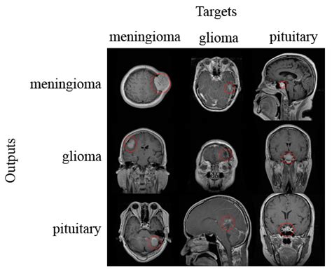 Applied Sciences Free Full Text Classification Of Brain Tumors From Mri Images Using A