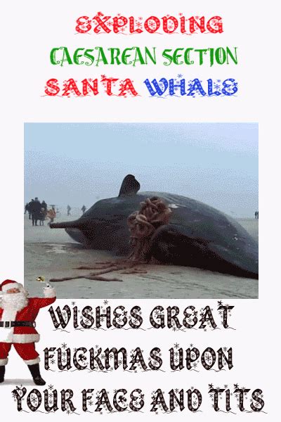 Exploding Caesarean Section Santa Whale Album On Imgur