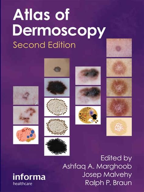 An Atlas Of Dermoscopy Second Edition Pdfdrive Pdf