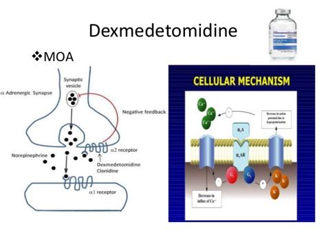 Dexmedetomidine A Novel Anesthetic Agent