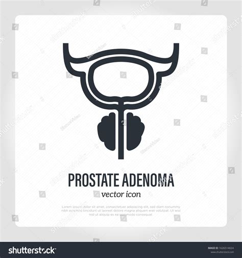 Prostate Adenoma Benign Prostatic Hyperplasia Thin 스톡 벡터 로열티 프리