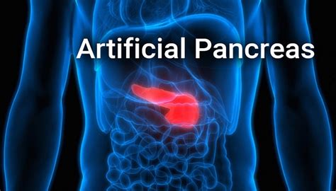 Artificial Pancreas Trials