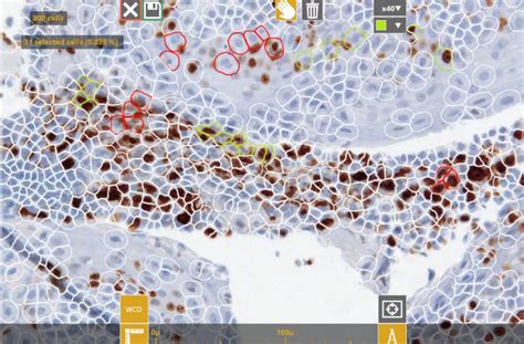 Luminate The Microscope With Digital Pathology Augmentiqs