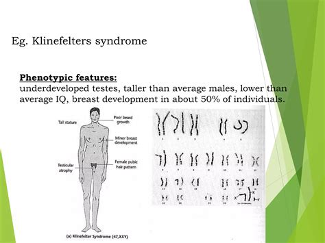 Mutation Gene And Chromosomal Pptx