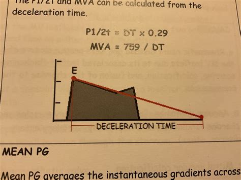 Dt Method Diagram Quizlet