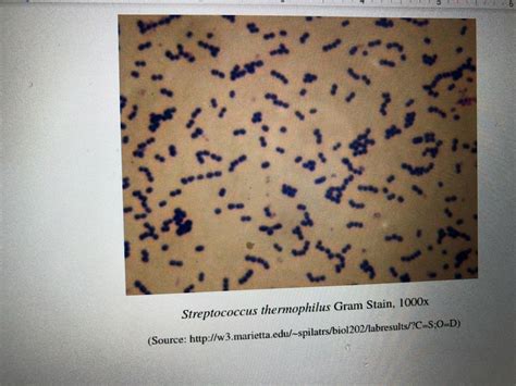 Proteus Vulgaris Gram Stain 1000x