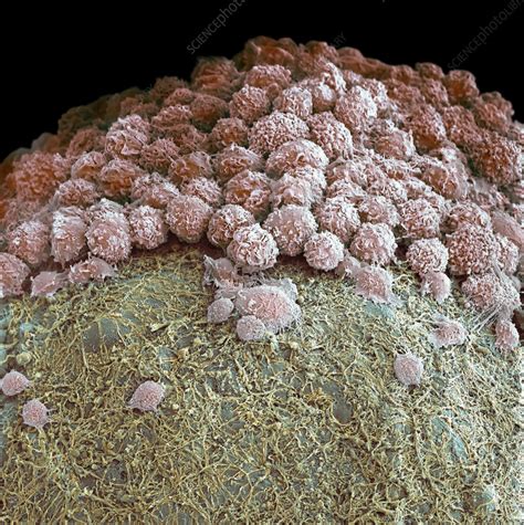 Organoid Sem Stock Image C0576893 Science Photo Library