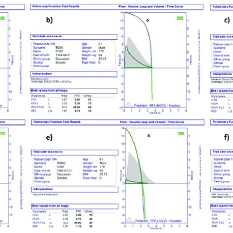 Figure A2 Spirometry Measurements Of The Artificial Patient The Download Scientific Diagram