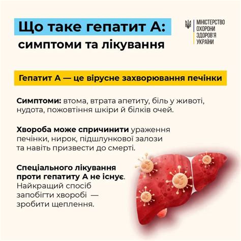 Гепатит А симптоми та лікування Закарпаття Інфо