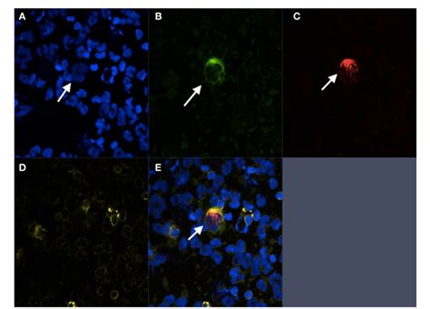 Figure 1 From Isolation And Characterization Of Circulating Tumor Cells
