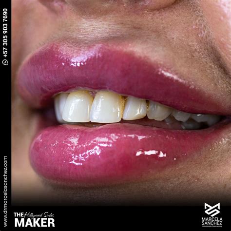 Dra Marcela Sanchez H Santiago De Cali