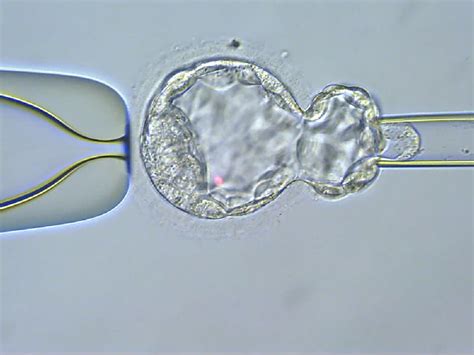 Ahmad Awartani On Linkedin Trophectoderm Biopsy Using Flick Method