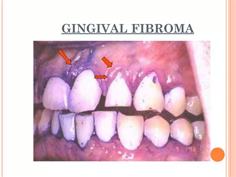 Genedermatosis Pdf Brain And Nervous System Disorders Diseases And Conditions