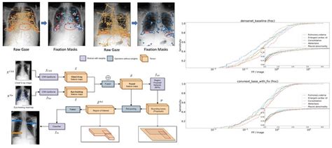 How Eyexnet Improves Radiologists Detection Catarina Moreira Posted On The Topic Linkedin