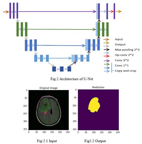 A Survey On Brain Tumor Segmentation Using Deep Learning For Mri Images