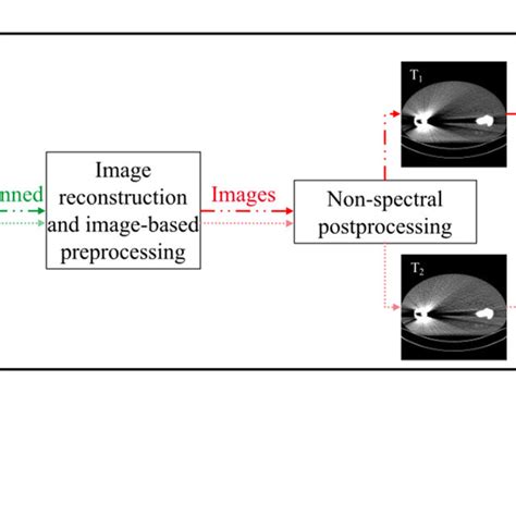 Simplified Pipeline Showing The Processing Of Spectral Photon Counting Download Scientific