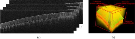 A A Series Of B Scans Of OCT Volume Data B An Example Of OCT Download Scientific Diagram