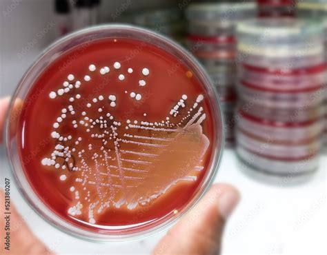 Staphylococcus Aureus Gram Positive To Gram Variable Nonmotile Coccus Beta Hemolysis