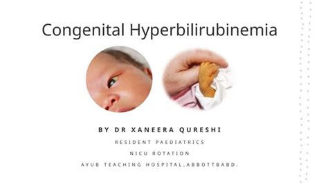 Unconjugated Hyperbilirubinemia By Dr Xaneera Pptx