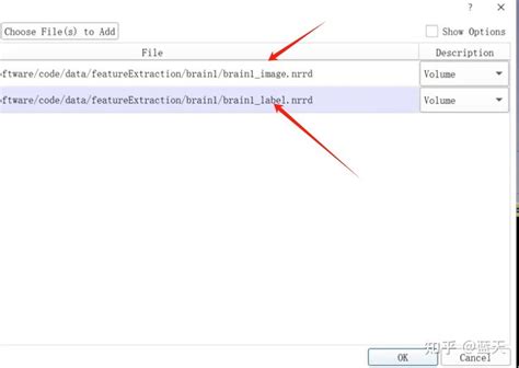 影像组学特征如何提取 知乎