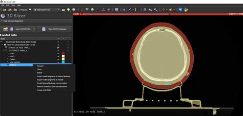 Exploring VTK Based D Modeling Of Floating Point RTStruct Contours In D Slicer Support D