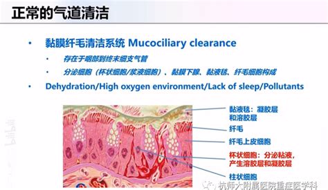 重症患者气道廓清治疗措施 医学界 助力医生临床决策和职业成长