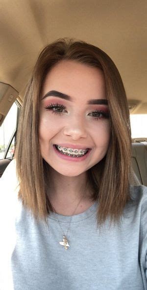 Juggernaut1919 Braces