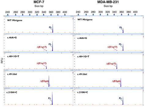Splicing Analysis Of 16 Palb2 Clinvar Variants By Minigene Assays Identification Of Six Likely