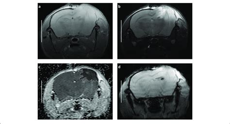 Demonstrating Main Radiological Features Of Decompressive Craniectomy Download Scientific
