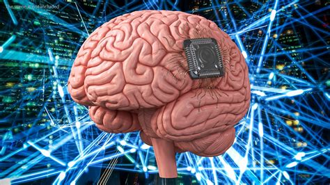 Human Brain With Implanted Microchip 3d Model Turbosquid 2262580