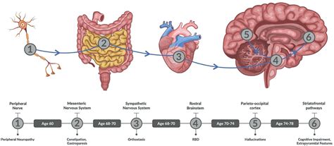 Braaks Unfinished Hypothesis A Clinicopathological Case Report Of α‐synuclein Peripheral
