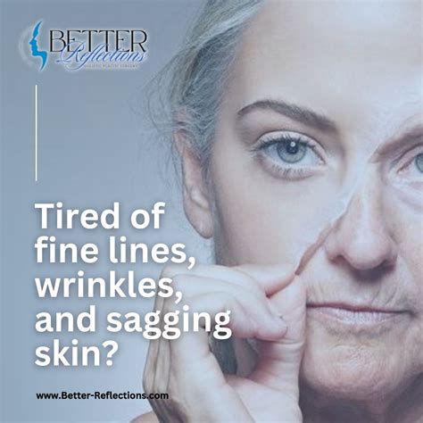 Boost Your Skin With Morpheus8 Jaime Bastidas Posted On The Topic Linkedin