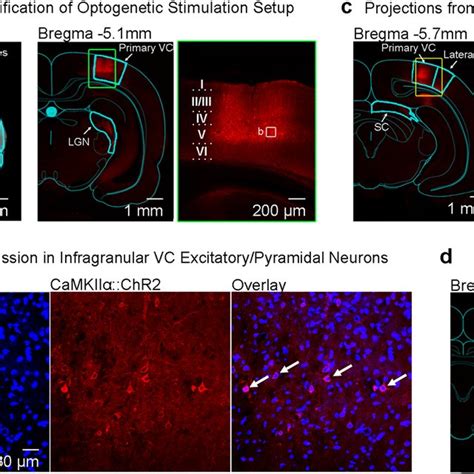 Optogenetic Stimulation Setup And Histological Characterization Of