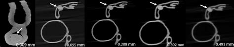 two dimensional micro computed tomography micro ct 0 009 mm slice