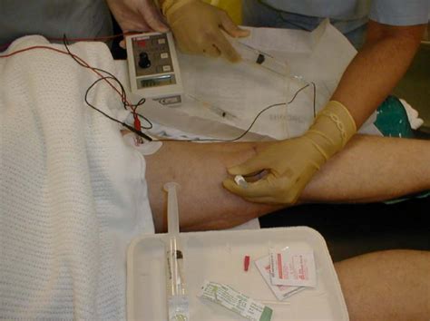 Popliteal Nerve Block Performed With The Patient Lying In Prone Position Download Scientific