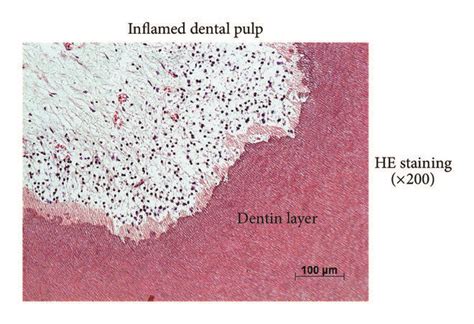 Expression Of Oct4b1 In The Dental Pulp Tissues With Inflammation A Download Scientific