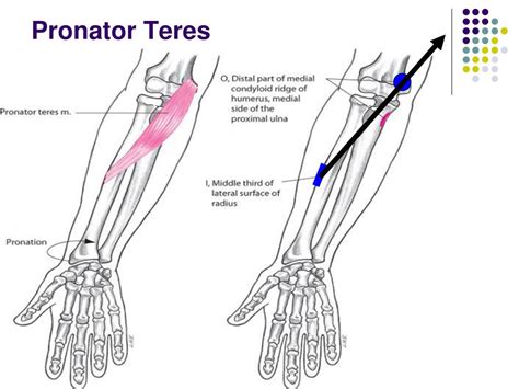Pronator Teres Muscle