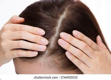 Scalp Stock Photos Images Photography Shutterstock