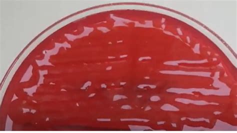 E Cloacae Introduction Morphology Pathogenicity Lab