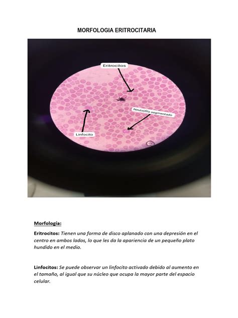 Morfologia Eritrocitaria Pdf